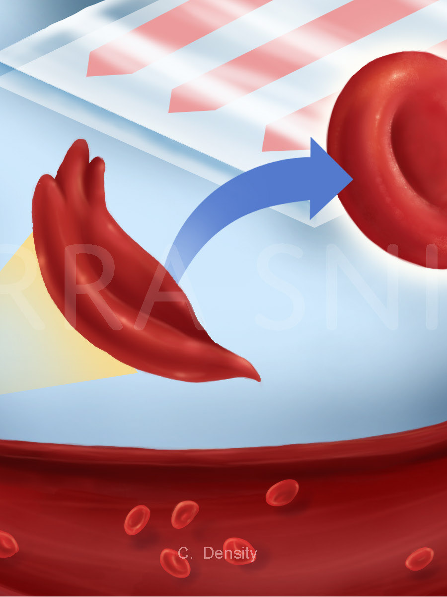 Sierra Snipes - Blue Crab Dissection